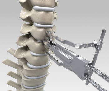 THE SPINE CLINIC | Aundh, Pune | Dr. Tushar J. Deore - Orthopedist ...